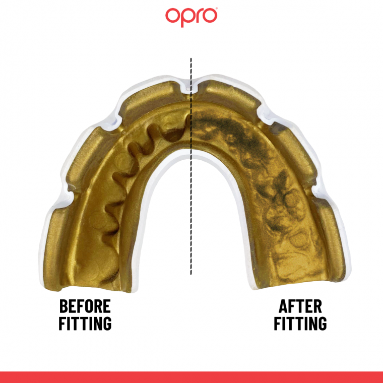 OPRO INSTANT CUSTOM-FIT ADULT BRACES WHITE GEN 5 – OPRO Mouthguards