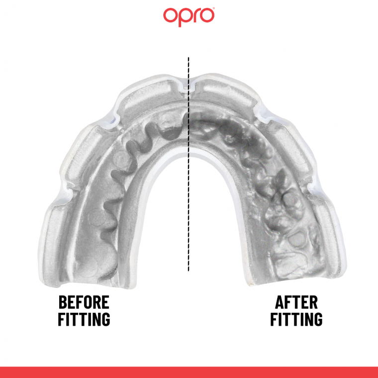 OPRO INSTANT CUSTOM-FIT ADULT BRACES BLACK GEN 5 – OPRO Mouthguards